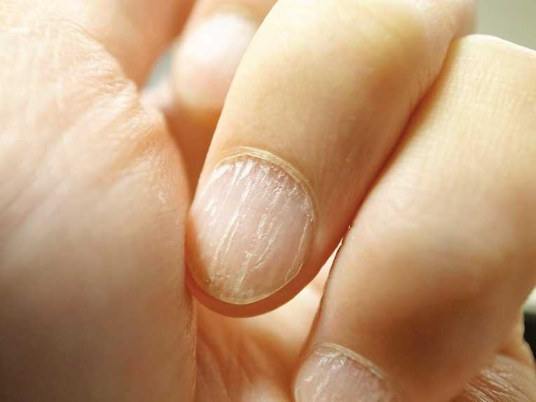 Pagar tributo reporte patrocinado oniquia punteada va a decidir Planeta ...